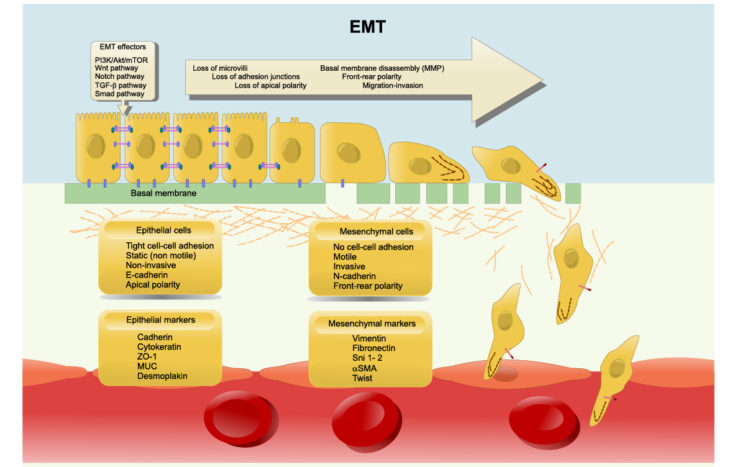 EMT Resistance in Cancer Cells and Two Potential Causes | Oncotarget
